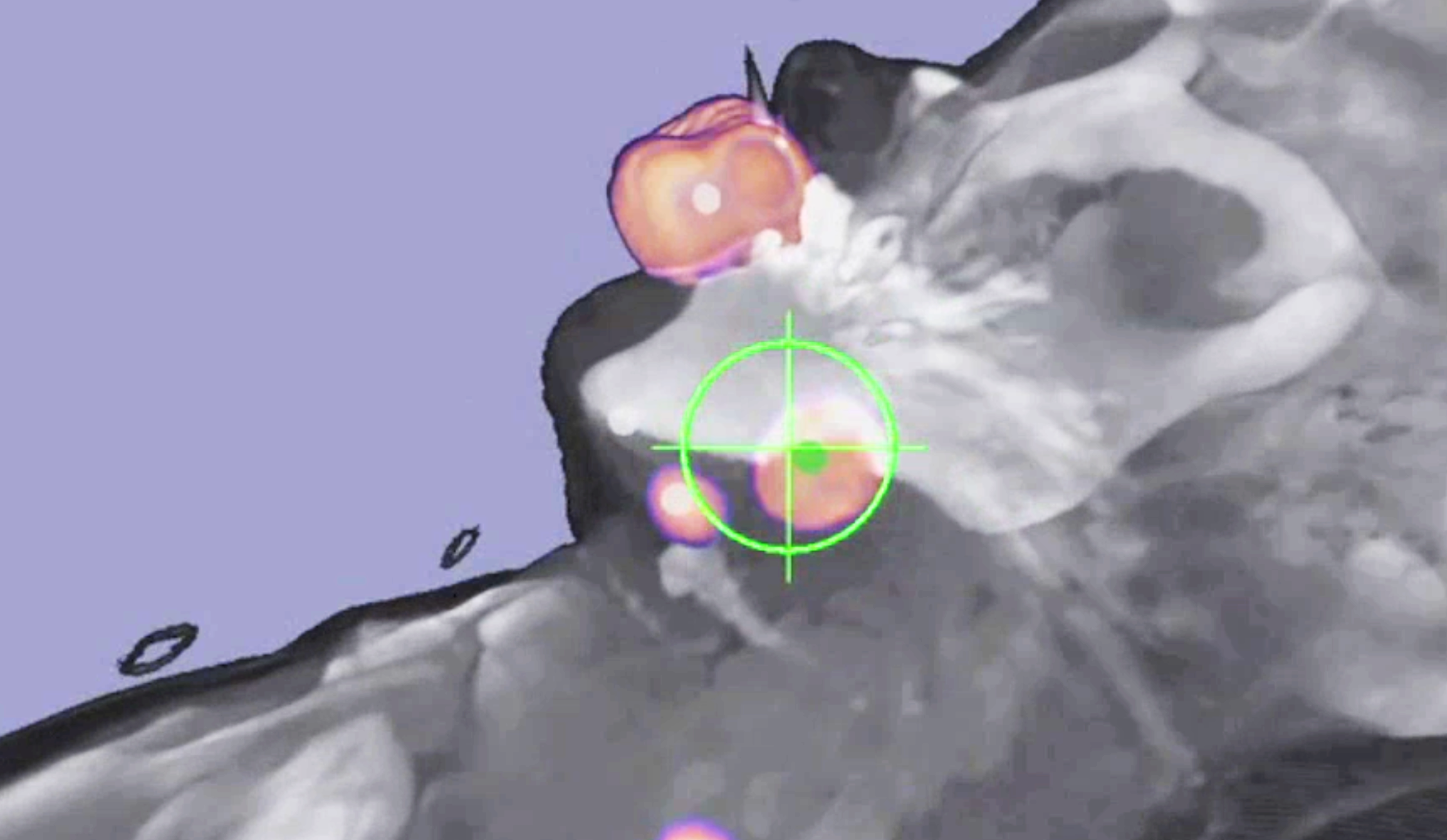 AR/VR Visualizations and Surgical Navigation - 3D-Lab+ 3DLab-LUMC