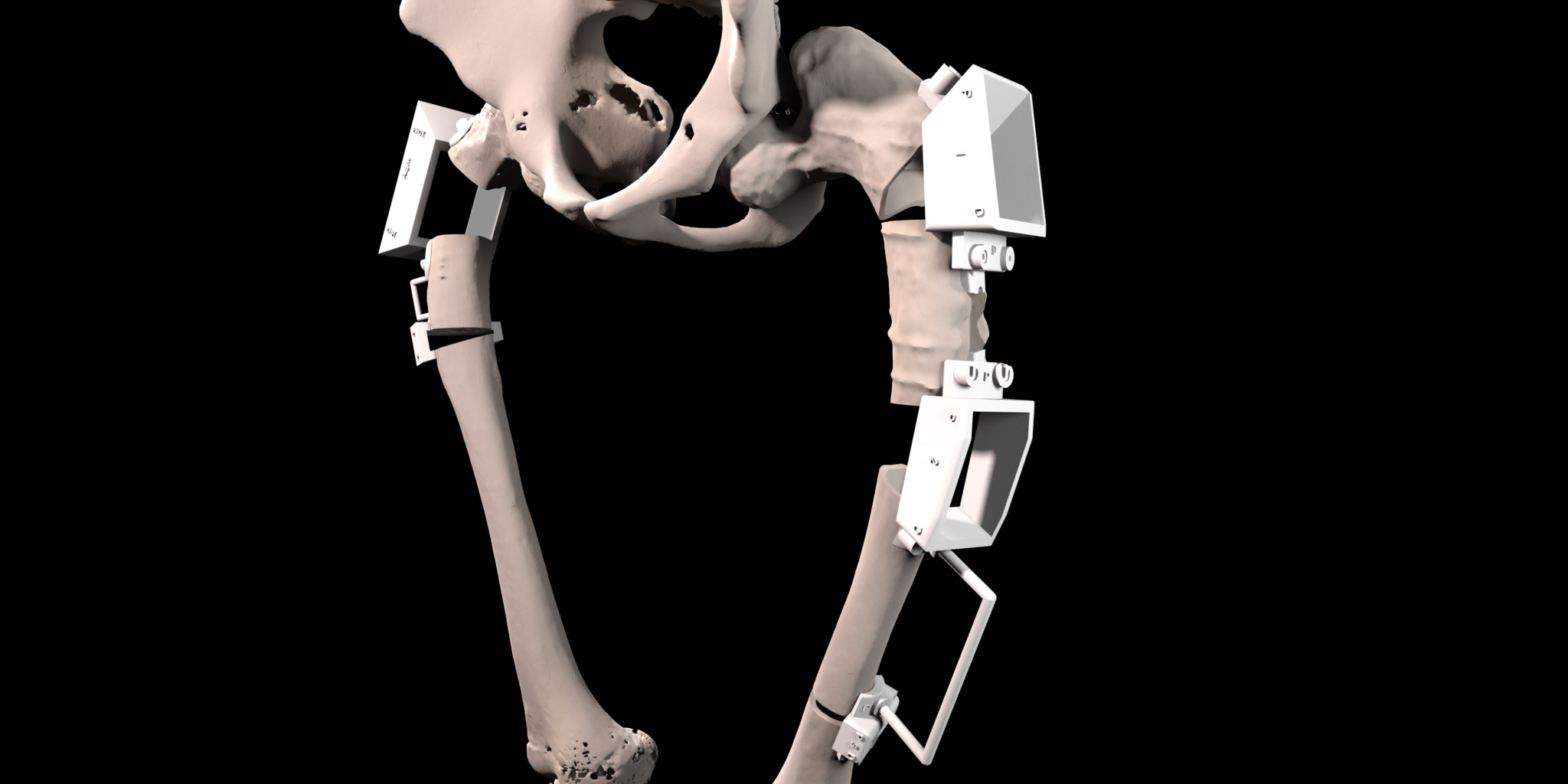 Full Femur Osteotomy - 3D-Lab+ 3DLab-LUMC