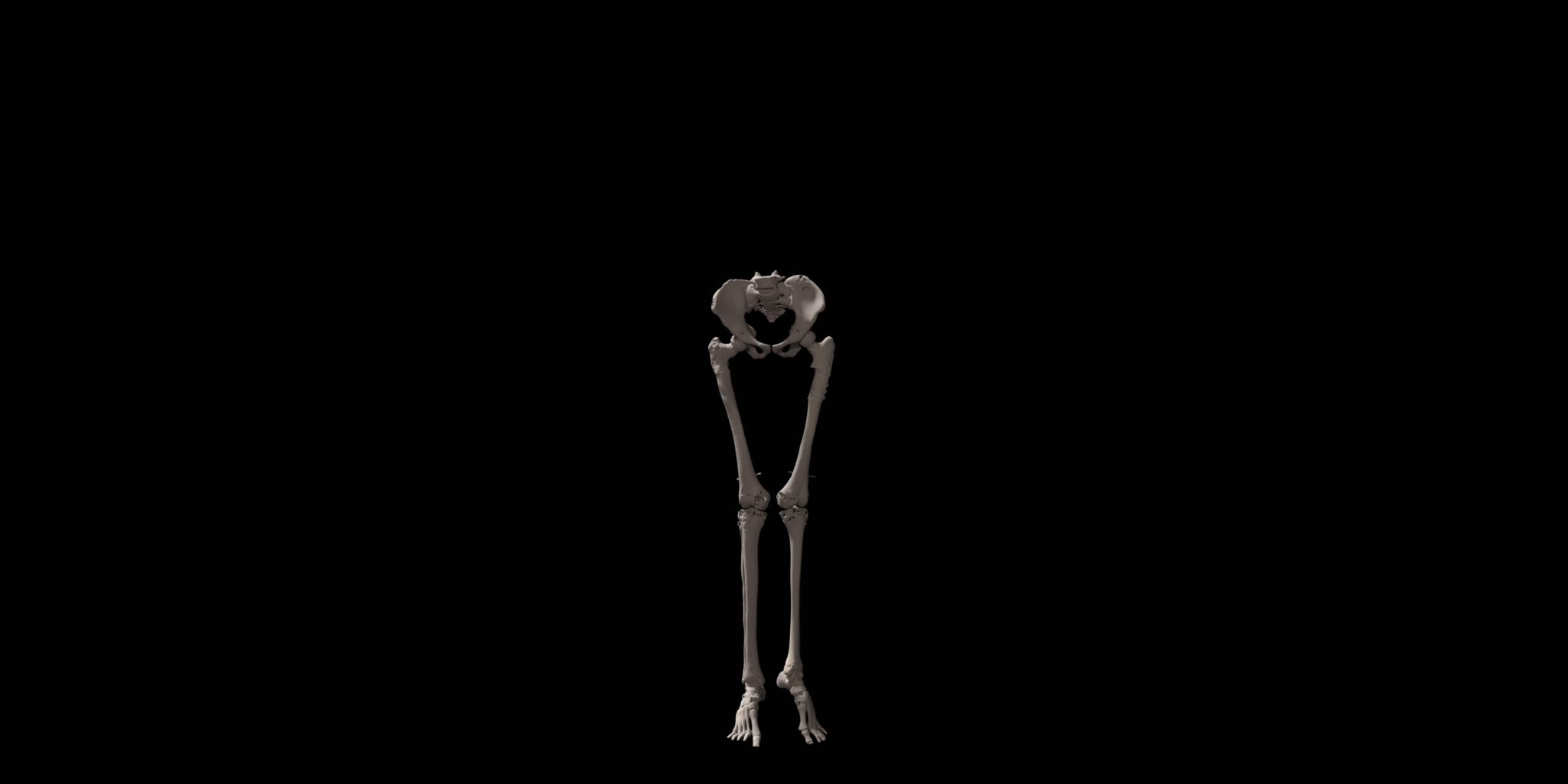 Full Femur Osteotomy - 3D-Lab+ 3DLab-LUMC