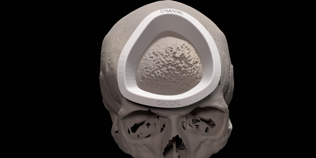 Neurosurgery - 3D-Lab+ 3DLab-LUMC