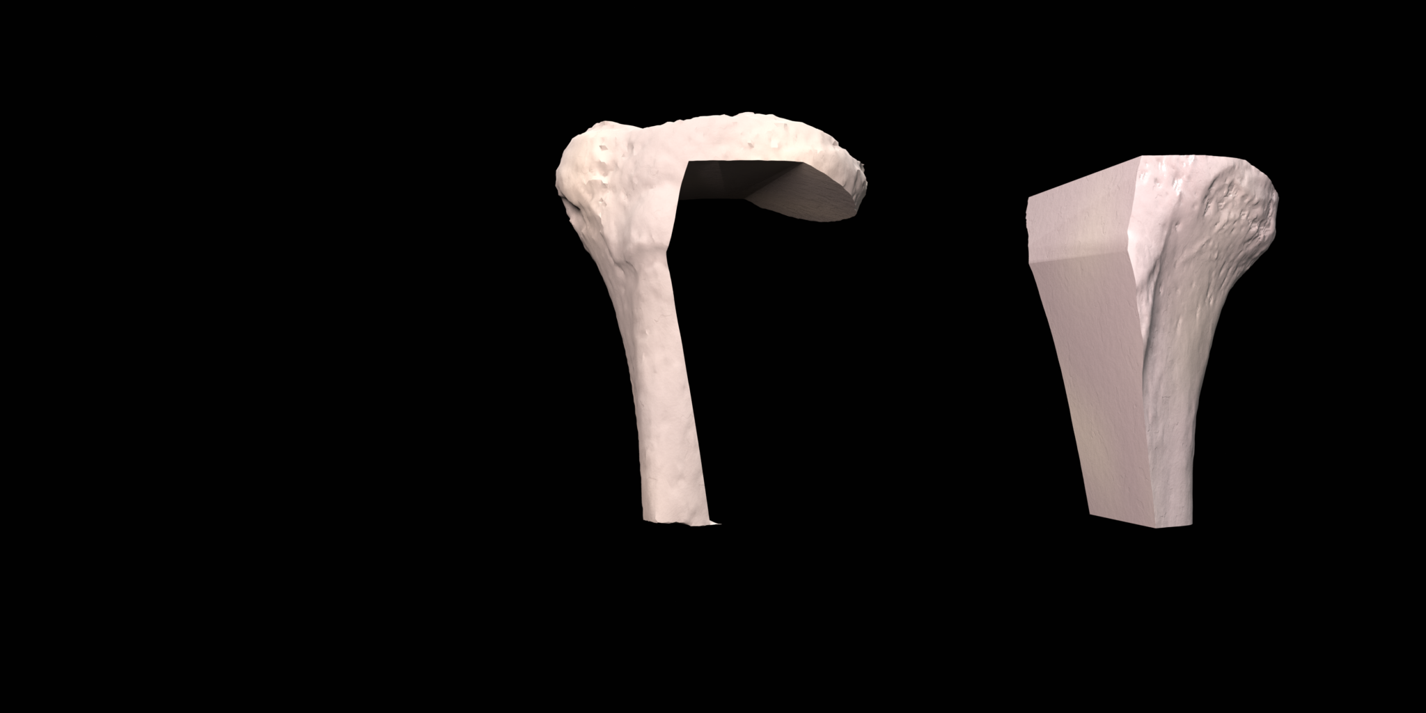 Allograft Reconstruction - 3D-Lab+ 3DLab-LUMC